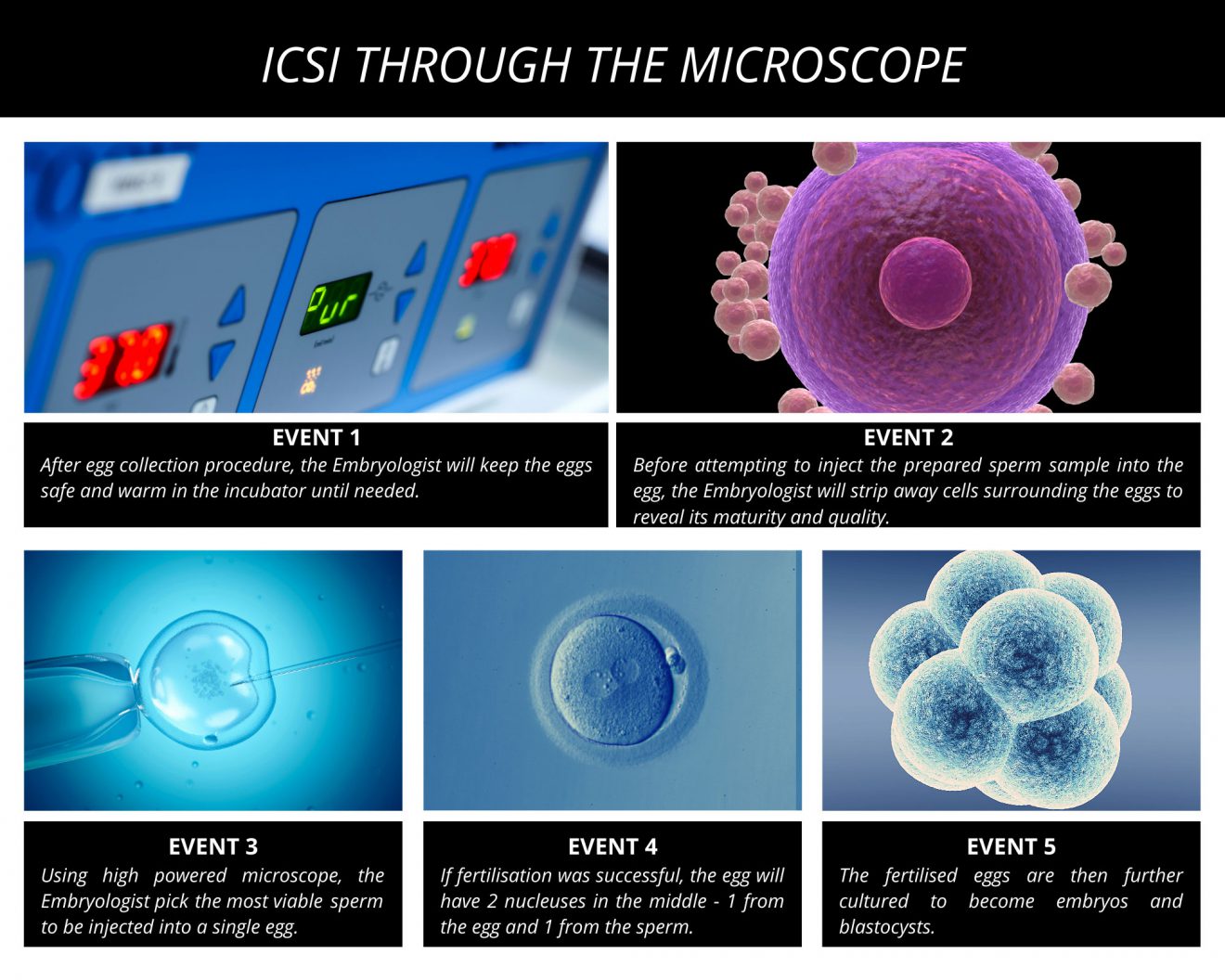 ICSI Process - KL Fertility Centre