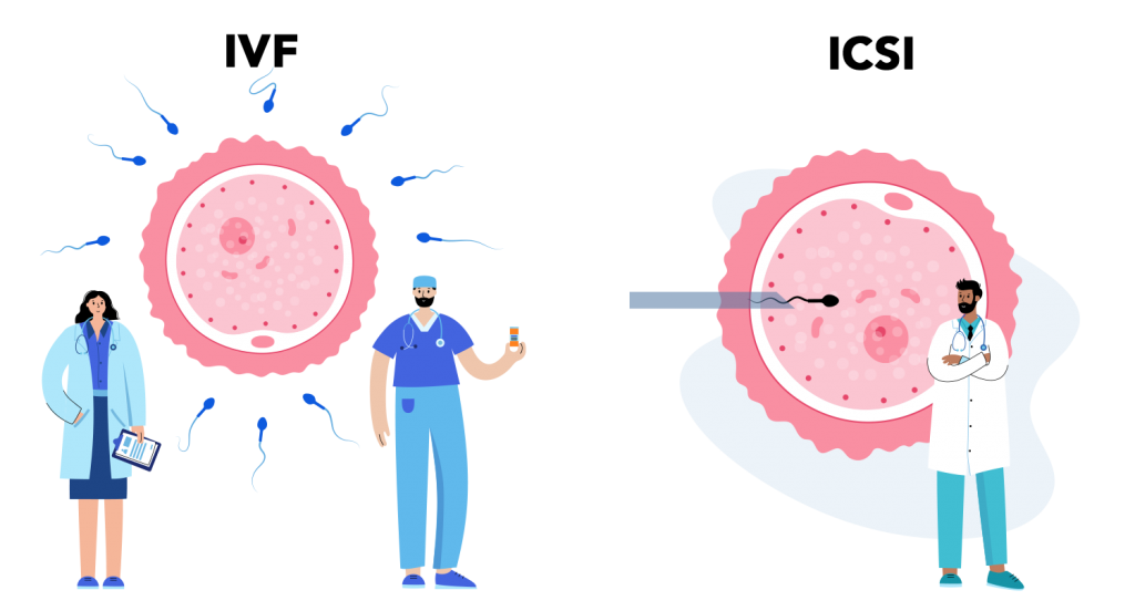 IVF and ICSI – What’s the Difference? - KL Fertility Centre
